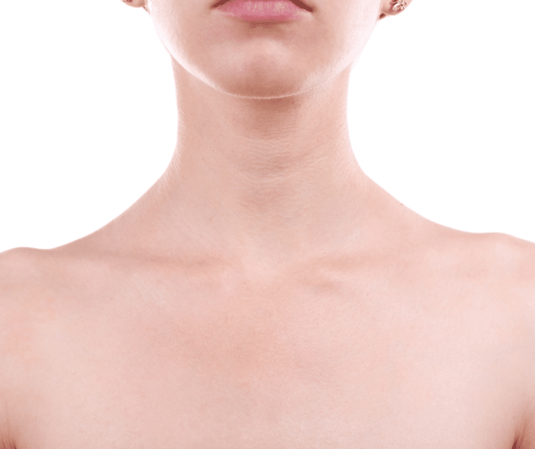 What is TRAP TOX??? - Gilbert Perfect Skin